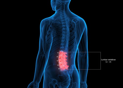 Lumbar Medial Branch Block and Radiofrequency Ablation (RFA) | Excel Pain and Spine