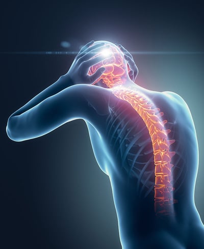 Epidural Blood Patch | Excel Pain and Spine